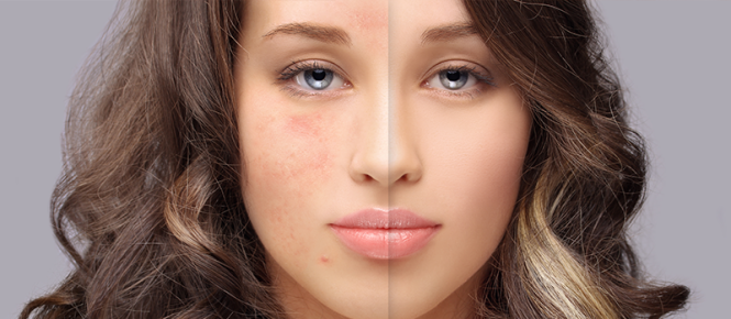 Compare o preço de Vitacid Xt 0 1perc nas melhores farmácias