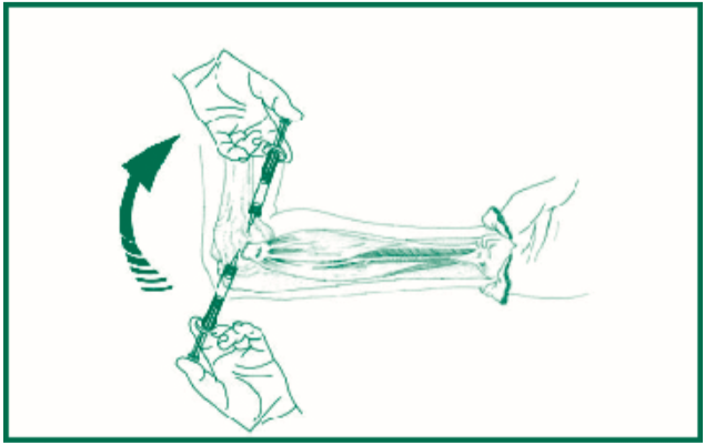 sportvis 12mg 1,2ml - Bula, para que serve e como tomar